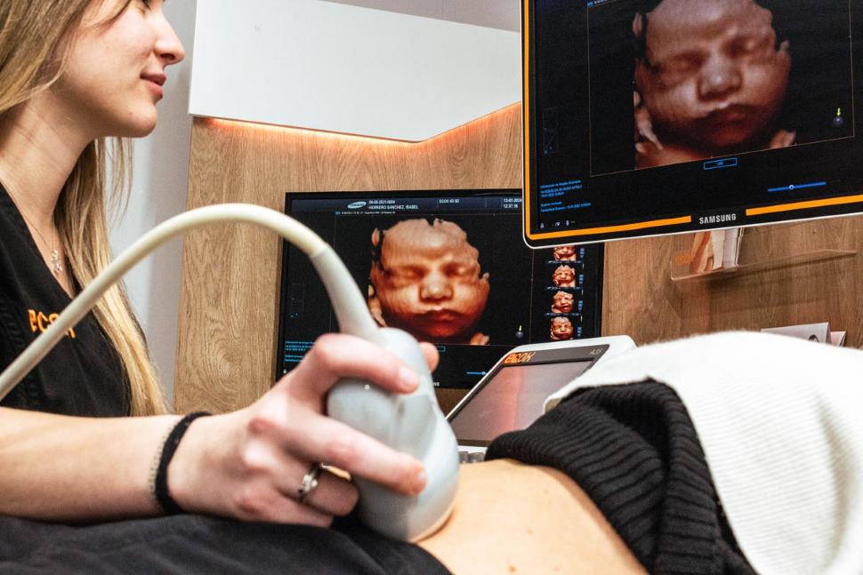 ¿Cuando hacer una Ecografía 5D? | Conoce el mejor momento